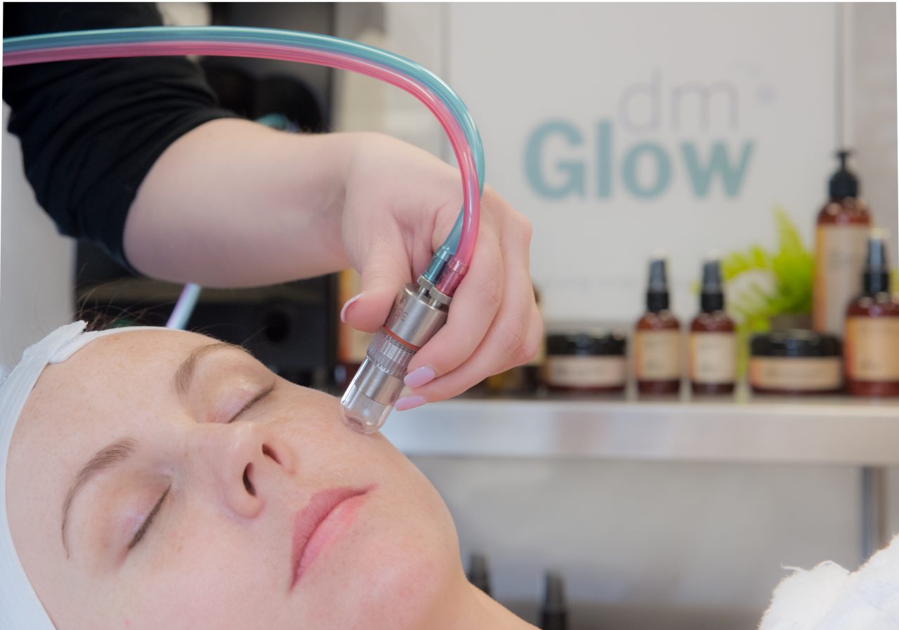 4 Reasons To Fall In Love with Microdermabrasion All Over Again