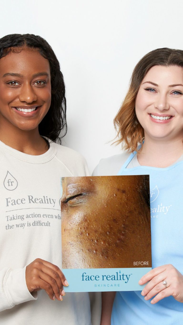 Want to be a Certified Acne Expert? - lipgloss + aftershave