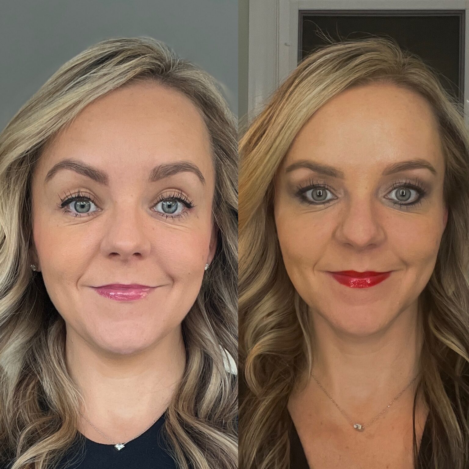 Medical Aesthetics LLC Offers New Injectable Skinvive