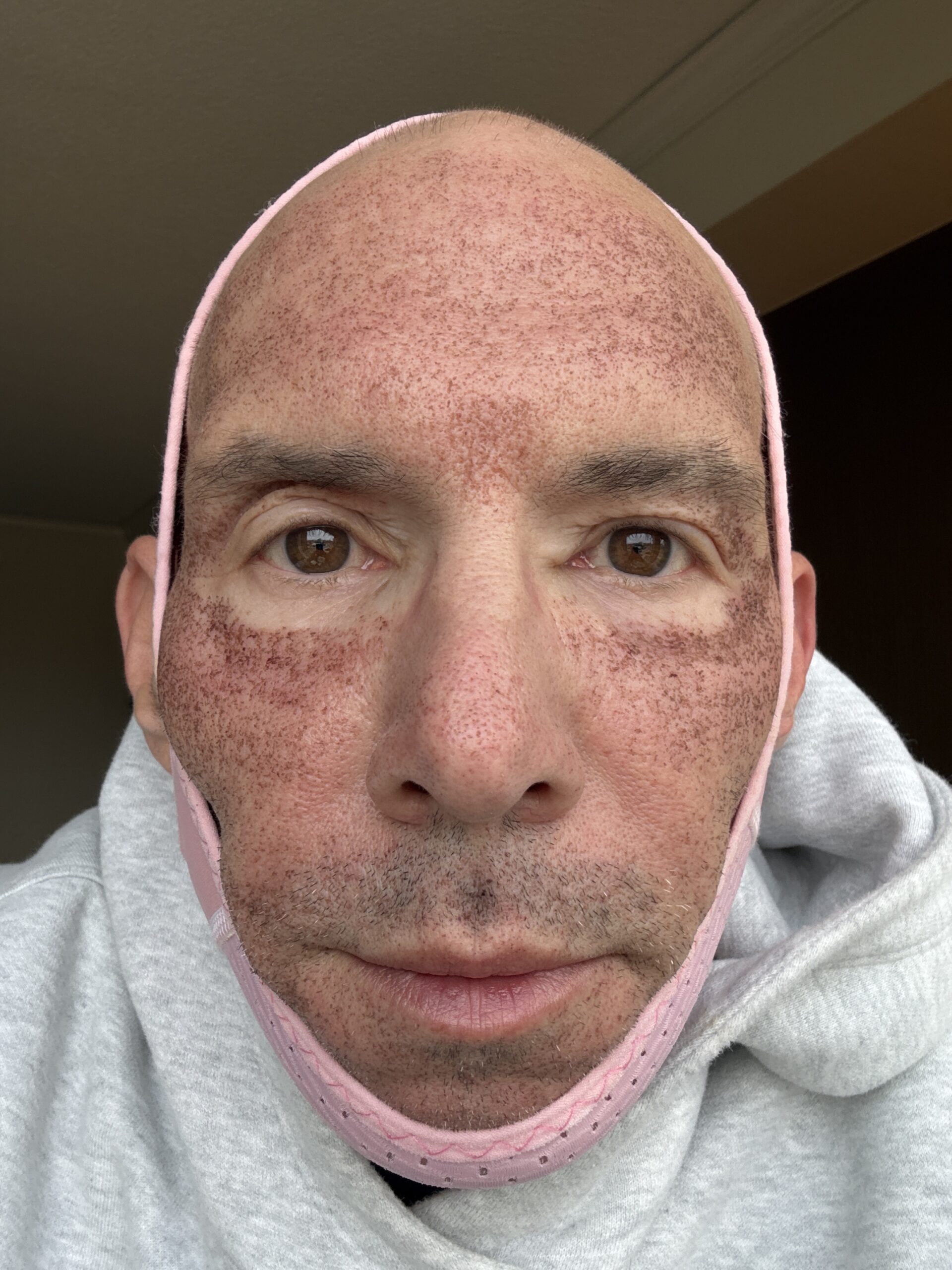 DefenAge PRO Skincare in Advanced Skincare Treatment Plans